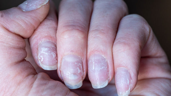 Why Your Nails Keep Peeling and How to Stop It – Beauty Market Online